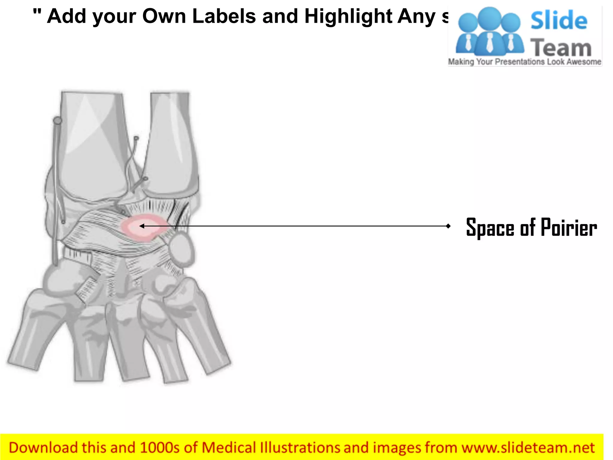 Wrist palmar medical images for power point | PDF