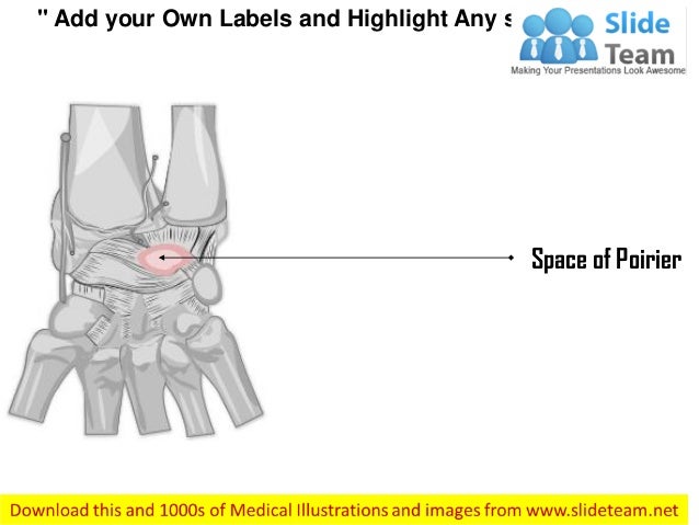 Wrist palmar medical images for power point