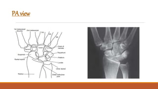 Wrist anatomy.ppt