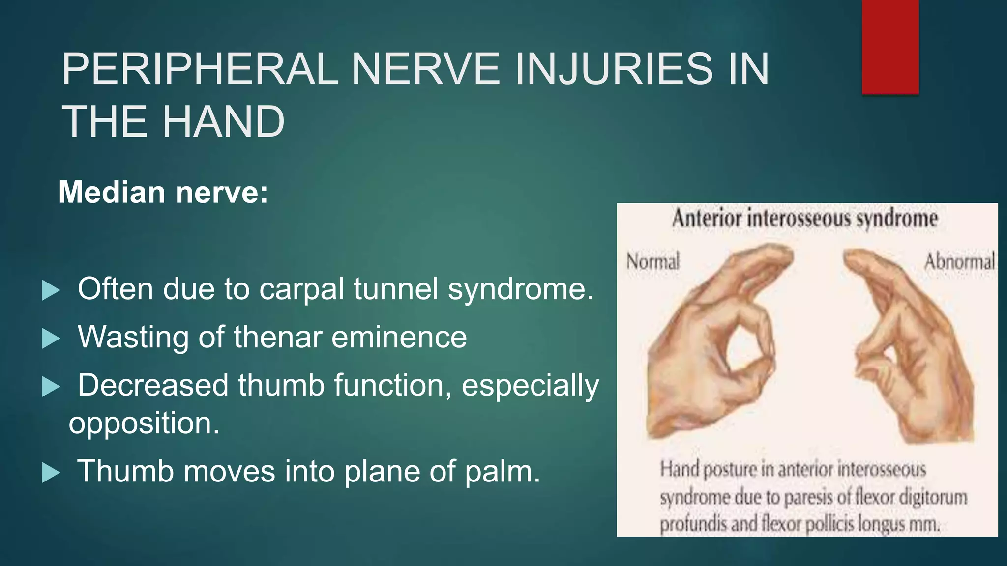 Biomechanics of wrist & Hand | PPTX