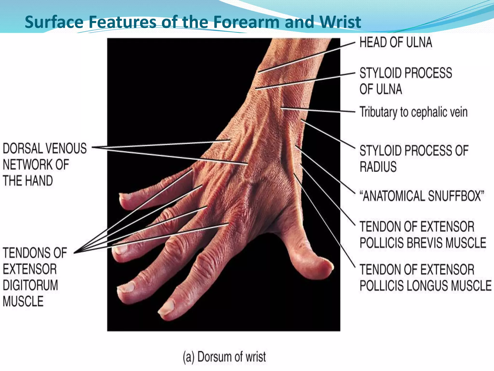 Wrist and hand examination | PPTX