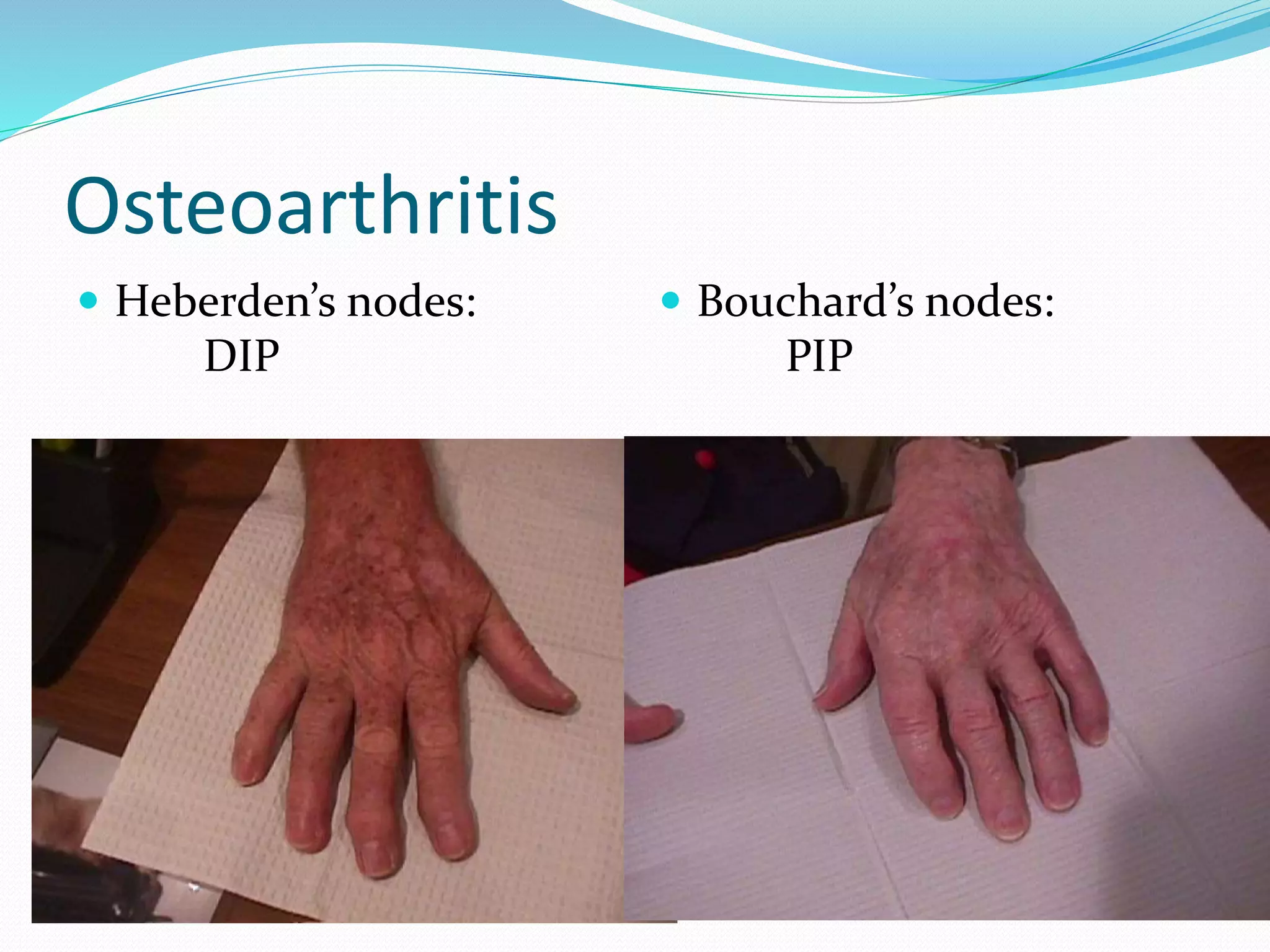 Wrist and hand examination | PPTX