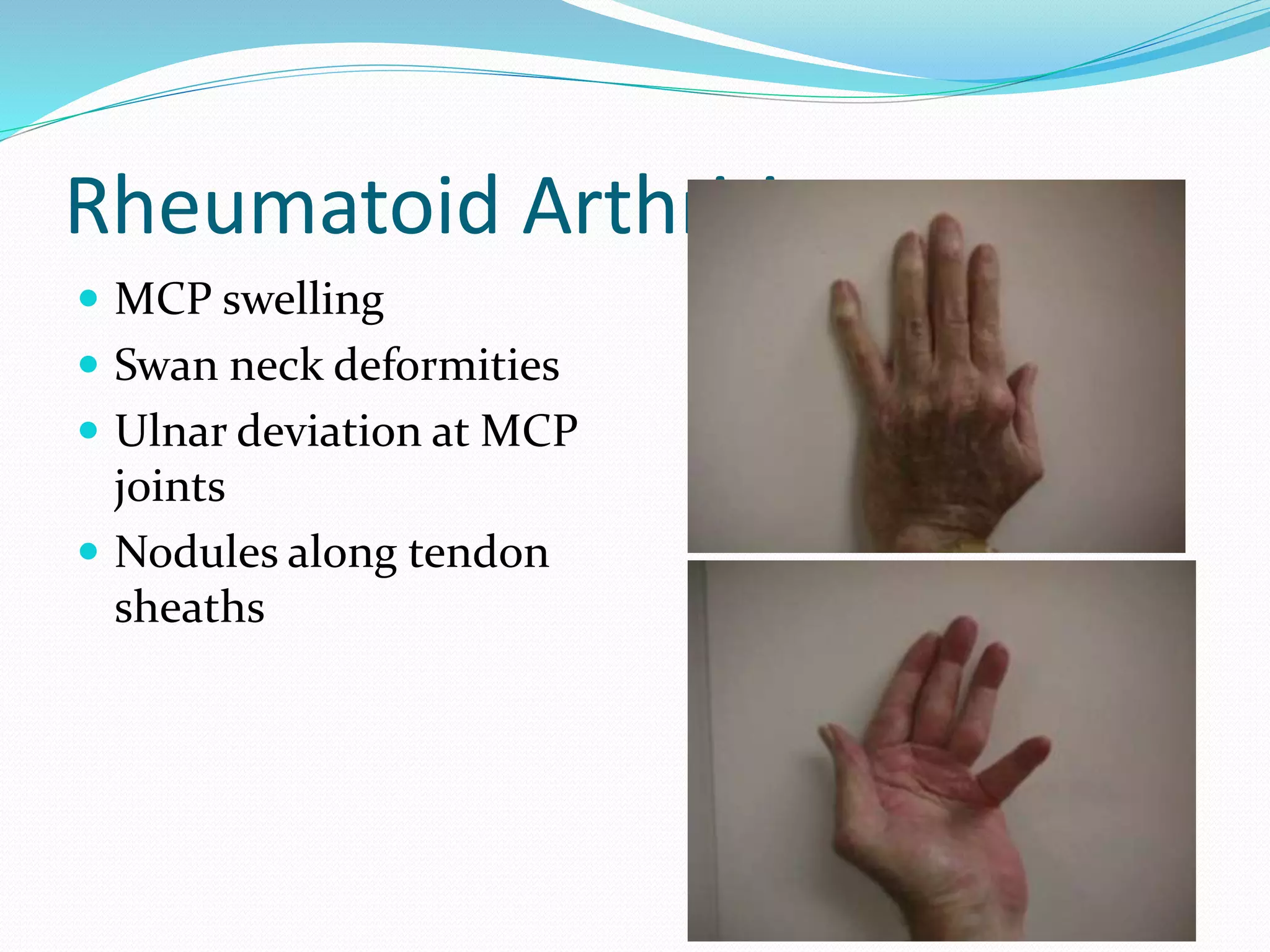 Wrist and hand examination | PPTX