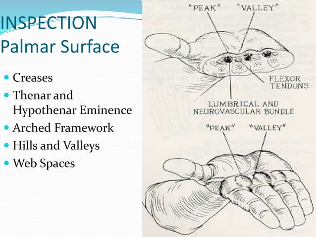 Wrist and hand examination | PPTX