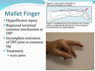 Wrist and hand examination | PPTX