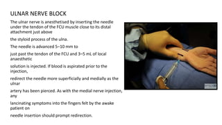 WRIST BLOCK, ANKLE BLOCK HIMANSHU BAXY.pptx