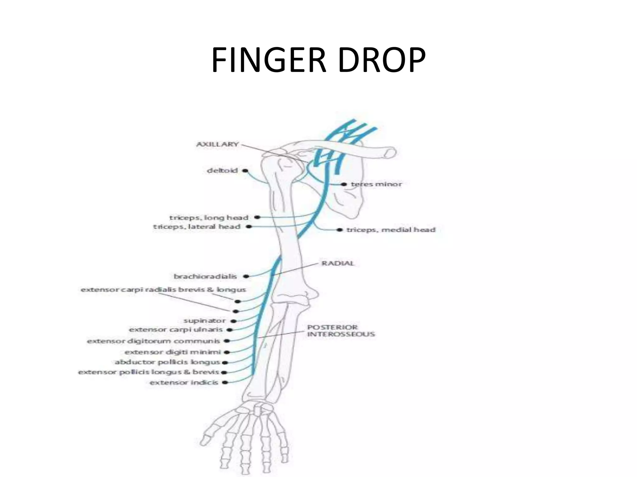 WRIST DROP,FINGERDROP, by parvathy new.pptx