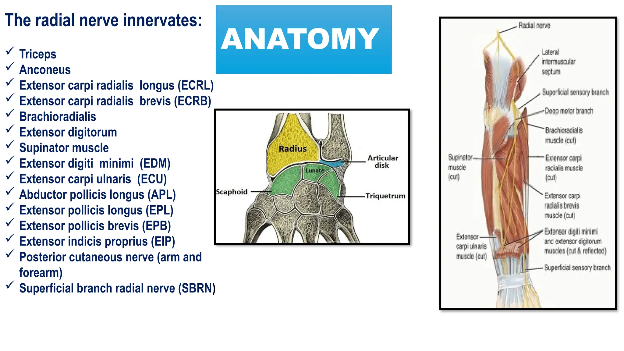 Wrist drop is also known as "Radial Nerve Palsy." | PPTX