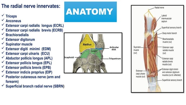 Wrist drop is also known as "Radial Nerve Palsy." | PPTX