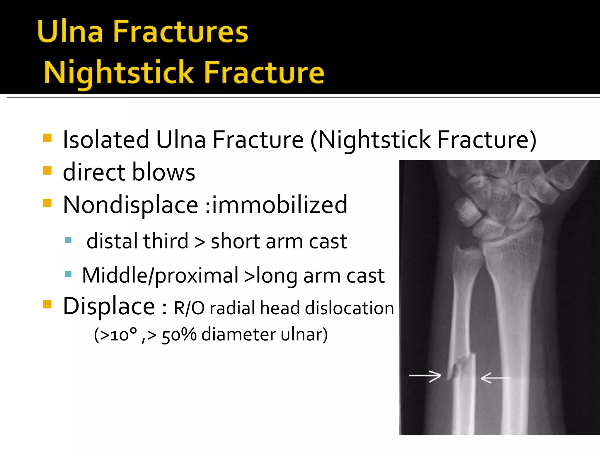 Wrist forearm elbow | PPT