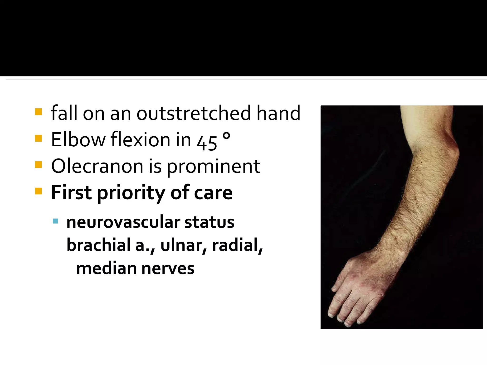 Wrist forearm elbow | PPT
