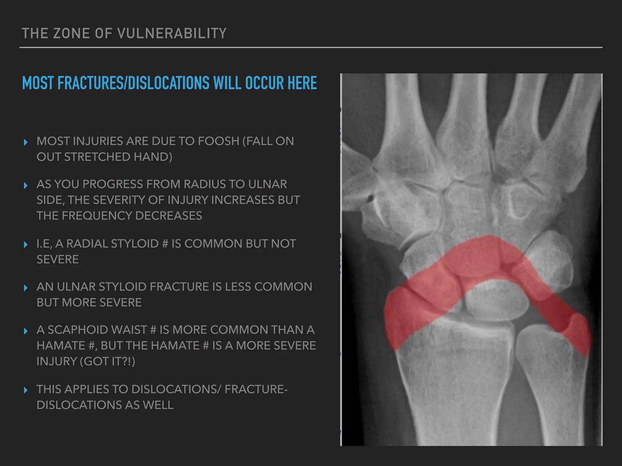 Wrist fractures pdf | PDF