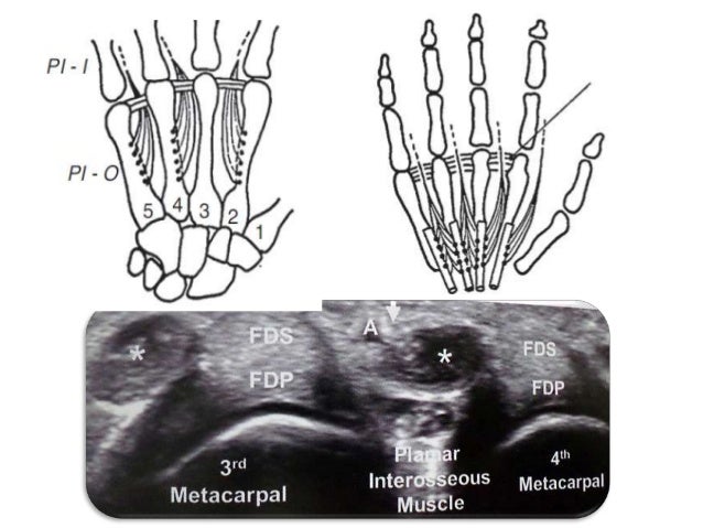 MSK US of Wrist & Hand MSK US of Wrist & Hand