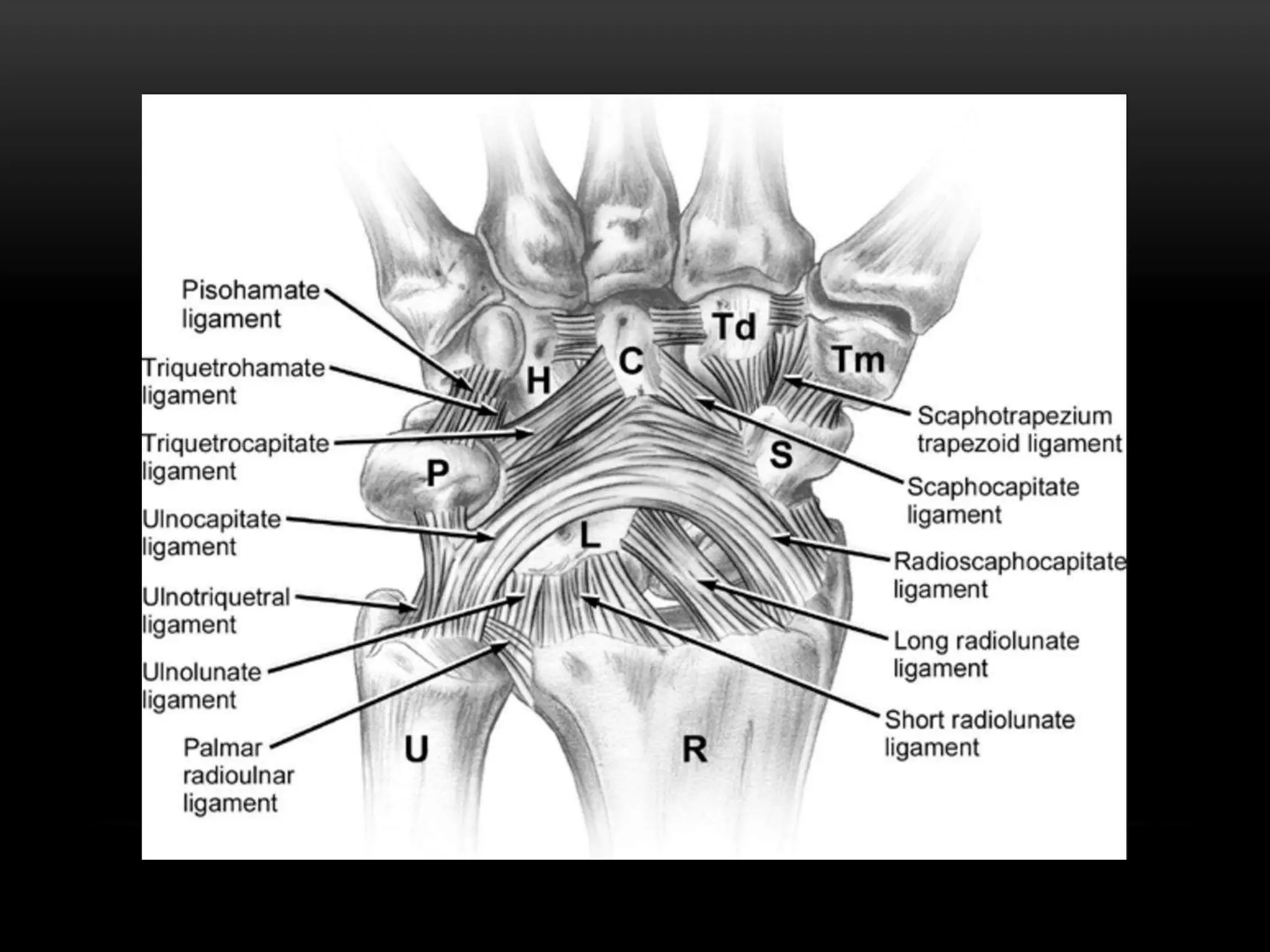 Wrist & hand complex | PPTX