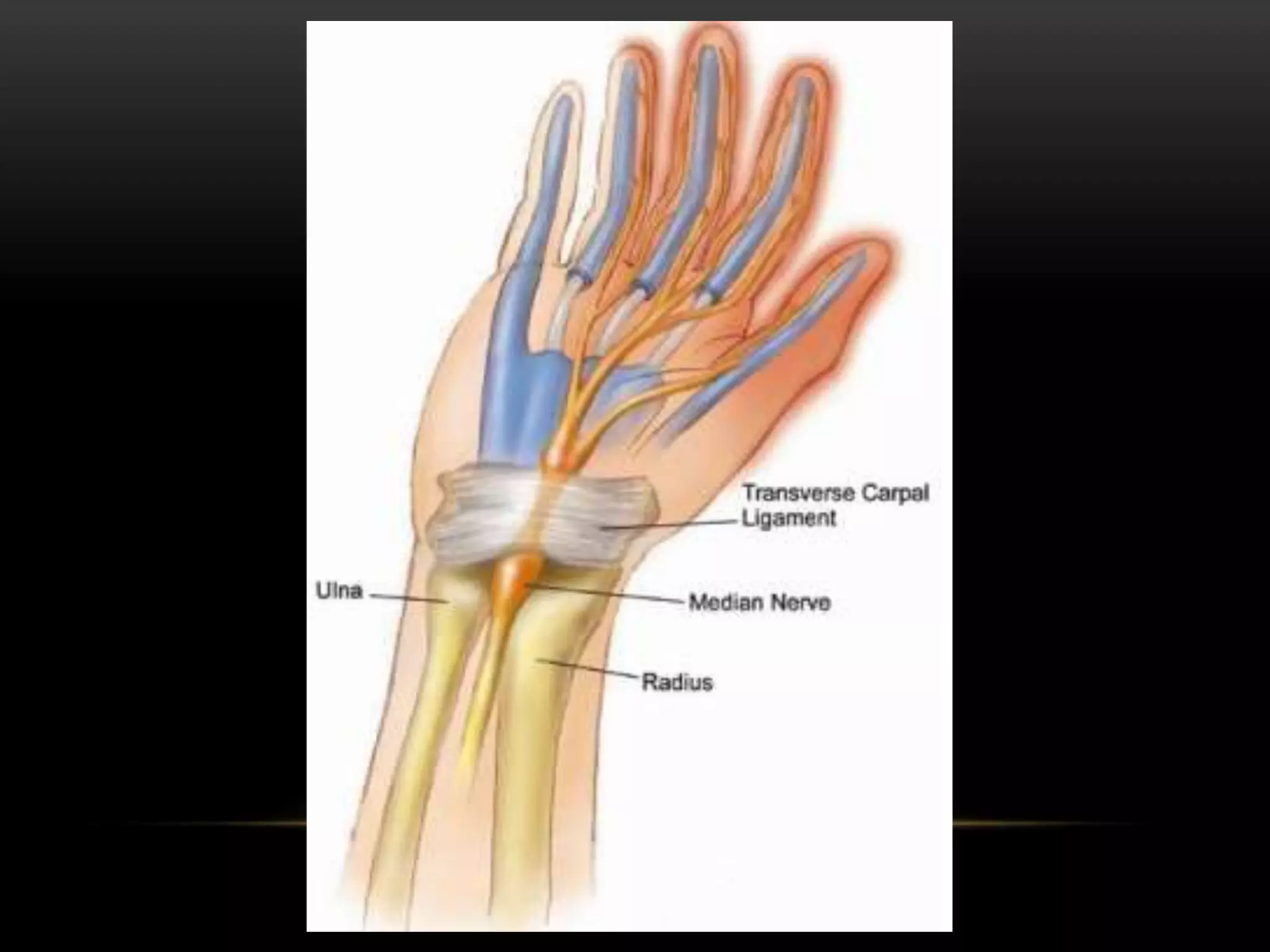 Wrist & hand complex | PPTX