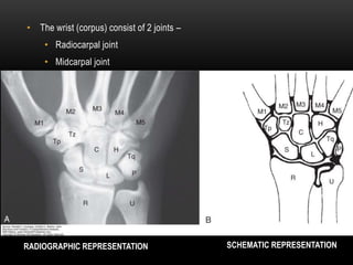 Wrist & hand complex | PPTX