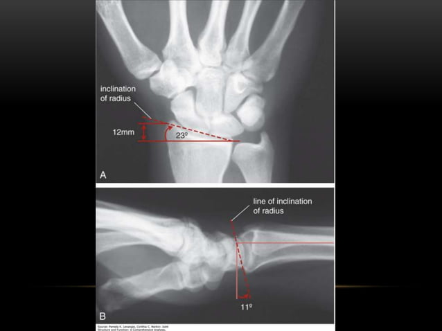 Wrist & hand complex | PPTX