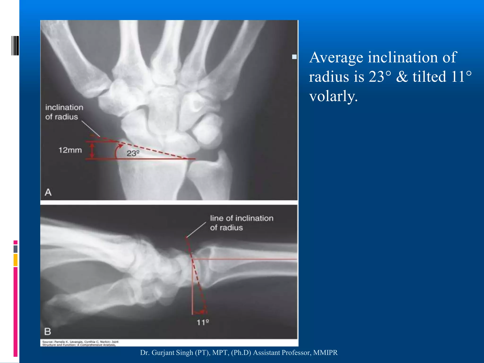 Biomechanics of Wrist and Hand Complex- Dr Gurjant Singh (PT) | PPTX