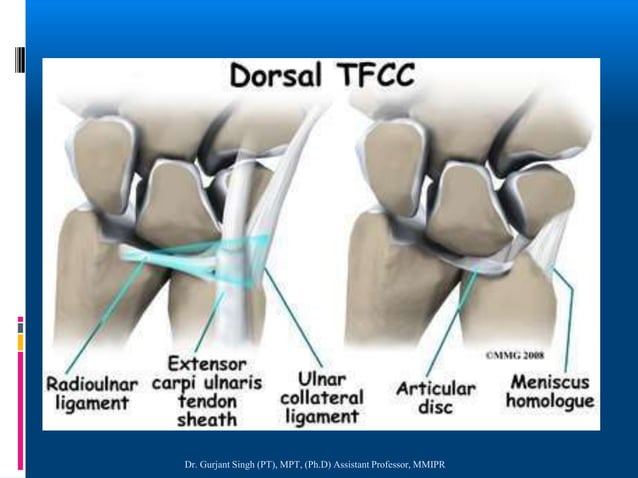 Biomechanics of Wrist and Hand Complex- Dr Gurjant Singh (PT) | PPTX ...