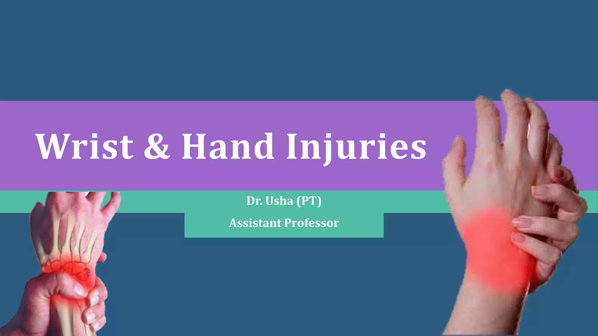 Wrist & hand injuries in sports | PPTX