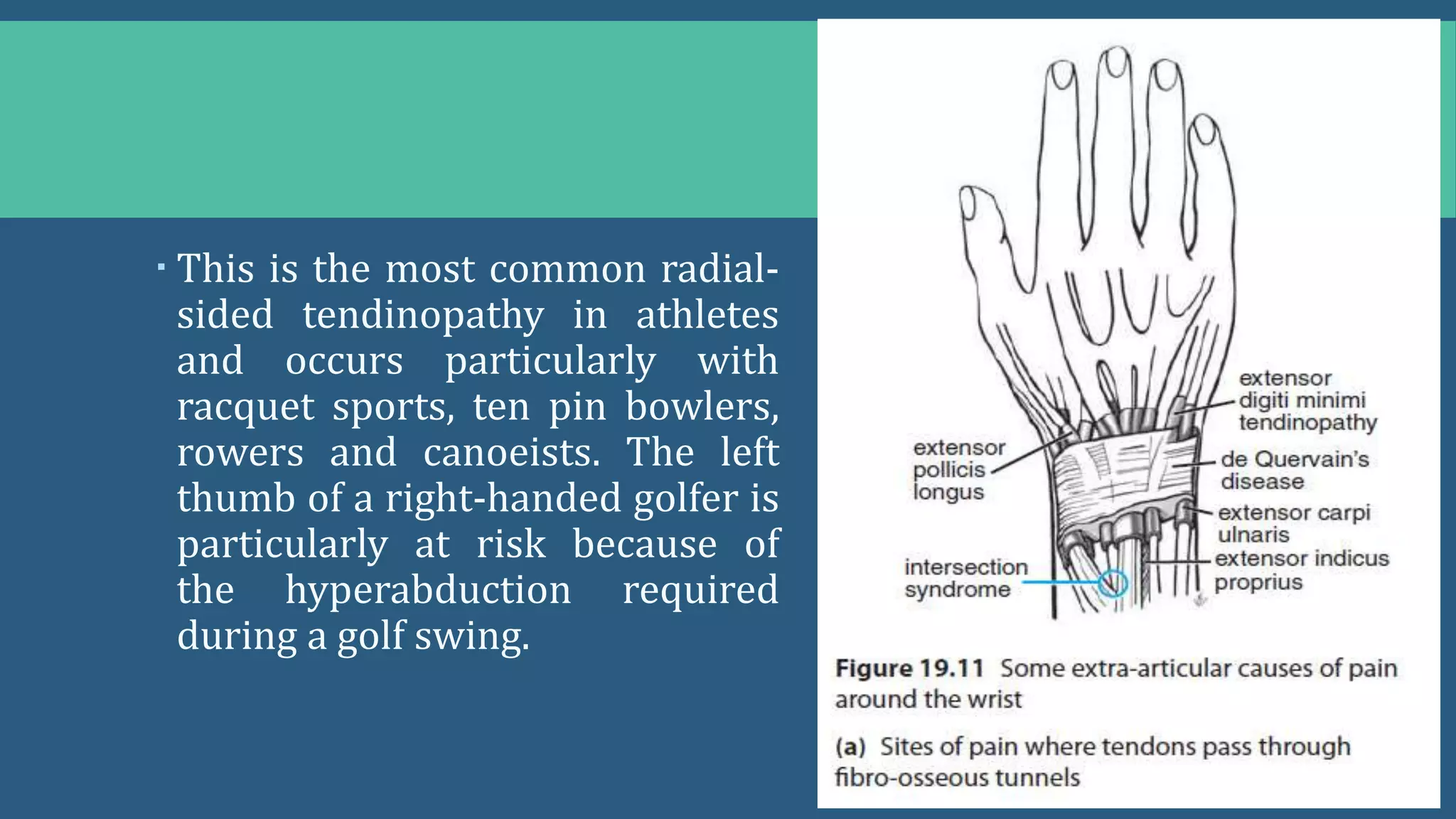 Wrist & hand injuries in sports | PPTX
