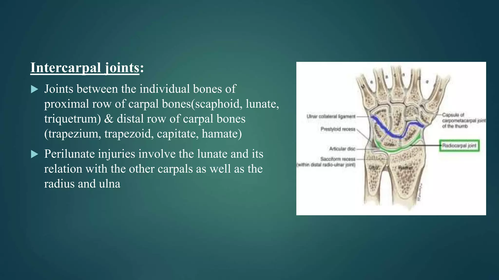Midcarpal Joint Wrist Joint Anatomy ( Bone, Joint ) #anatomy_upperlimb