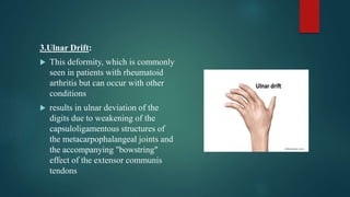 forearm, Wrist, hand joint anatomy & examination | PPTX