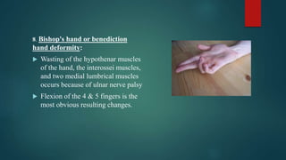 forearm, Wrist, hand joint anatomy & examination | PPTX