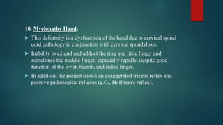 forearm, Wrist, hand joint anatomy & examination | PPTX