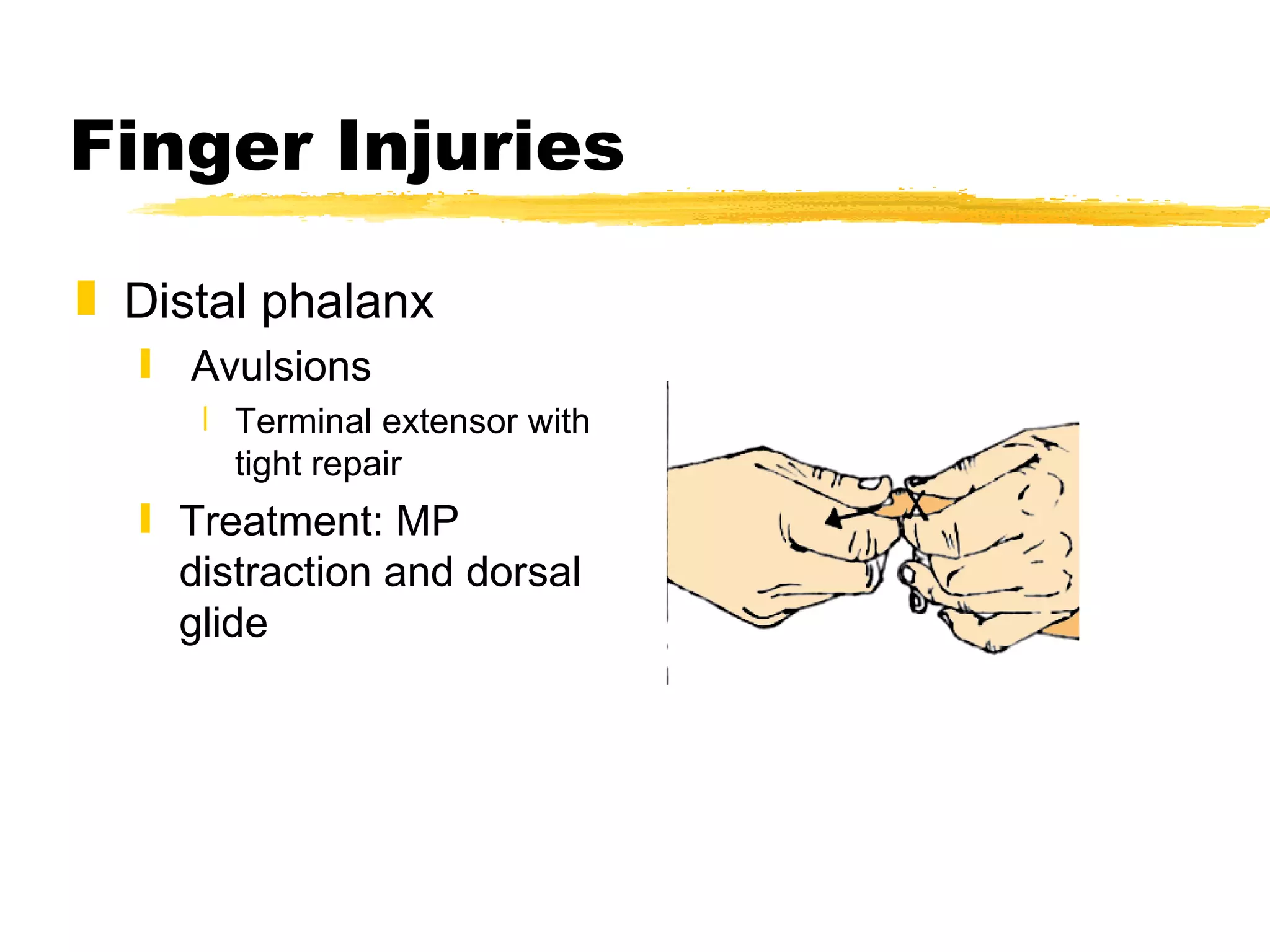 Wrist Hand Presentation | PPT