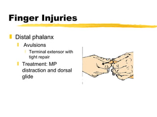 Wrist Hand Presentation | PPT