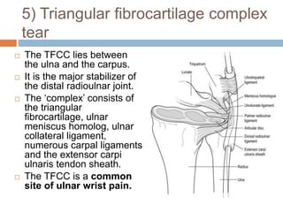 Wrist injuries | PPTX