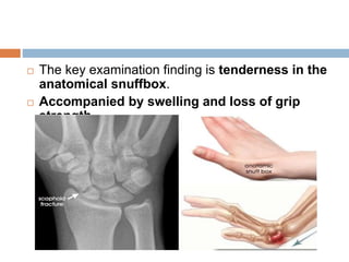Wrist injuries | PPTX