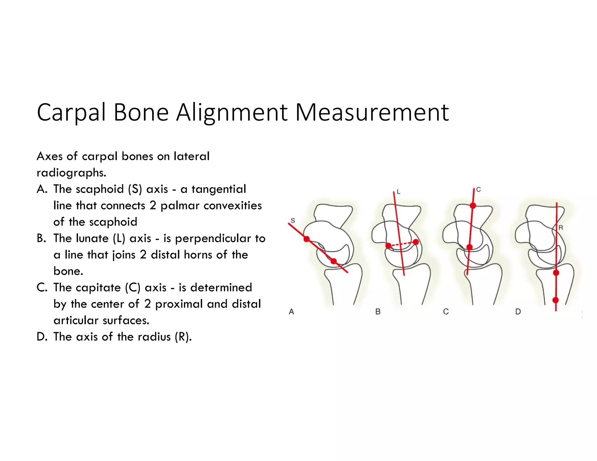 Wrist instability | PDF