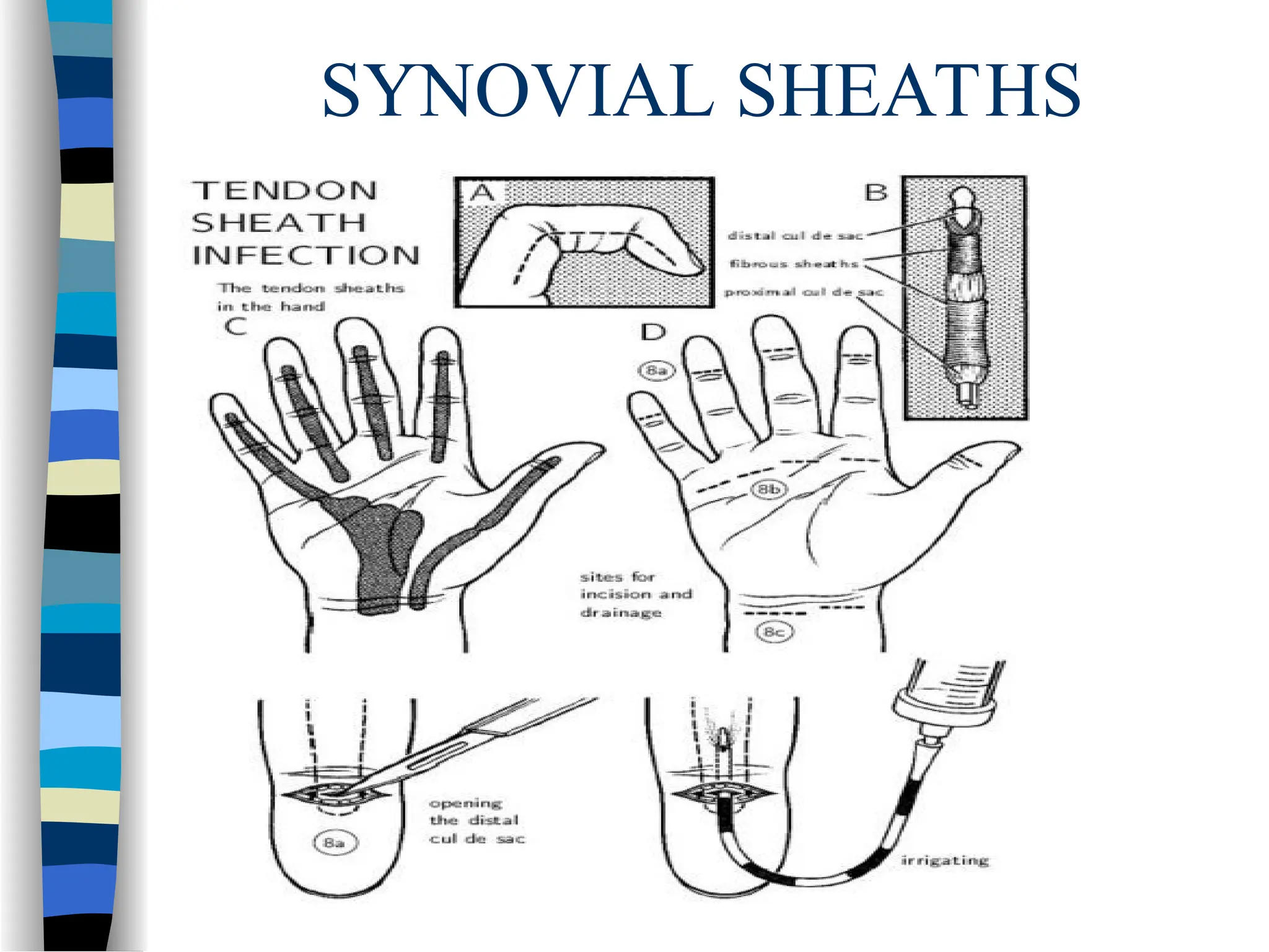 WRIST JOINT AND JOINTS IN THE HAND WITH APPLIED ASPECTS | PPT