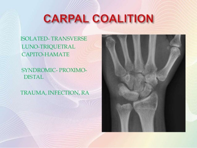 Wrist joint an imaging insight