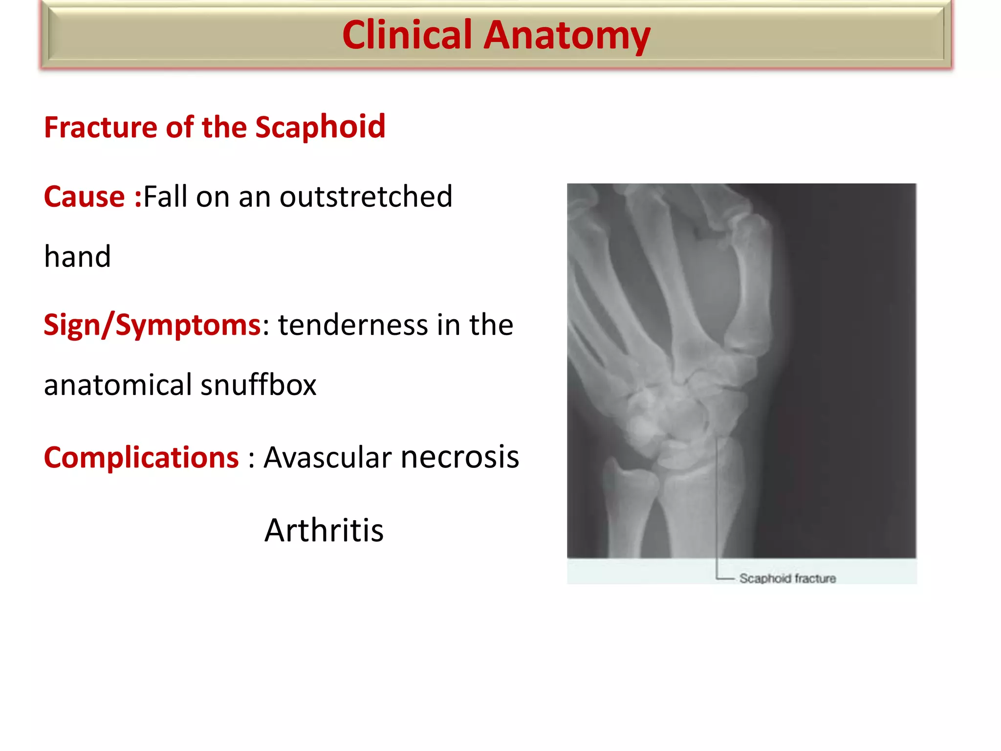 Wrist joint | PPTX
