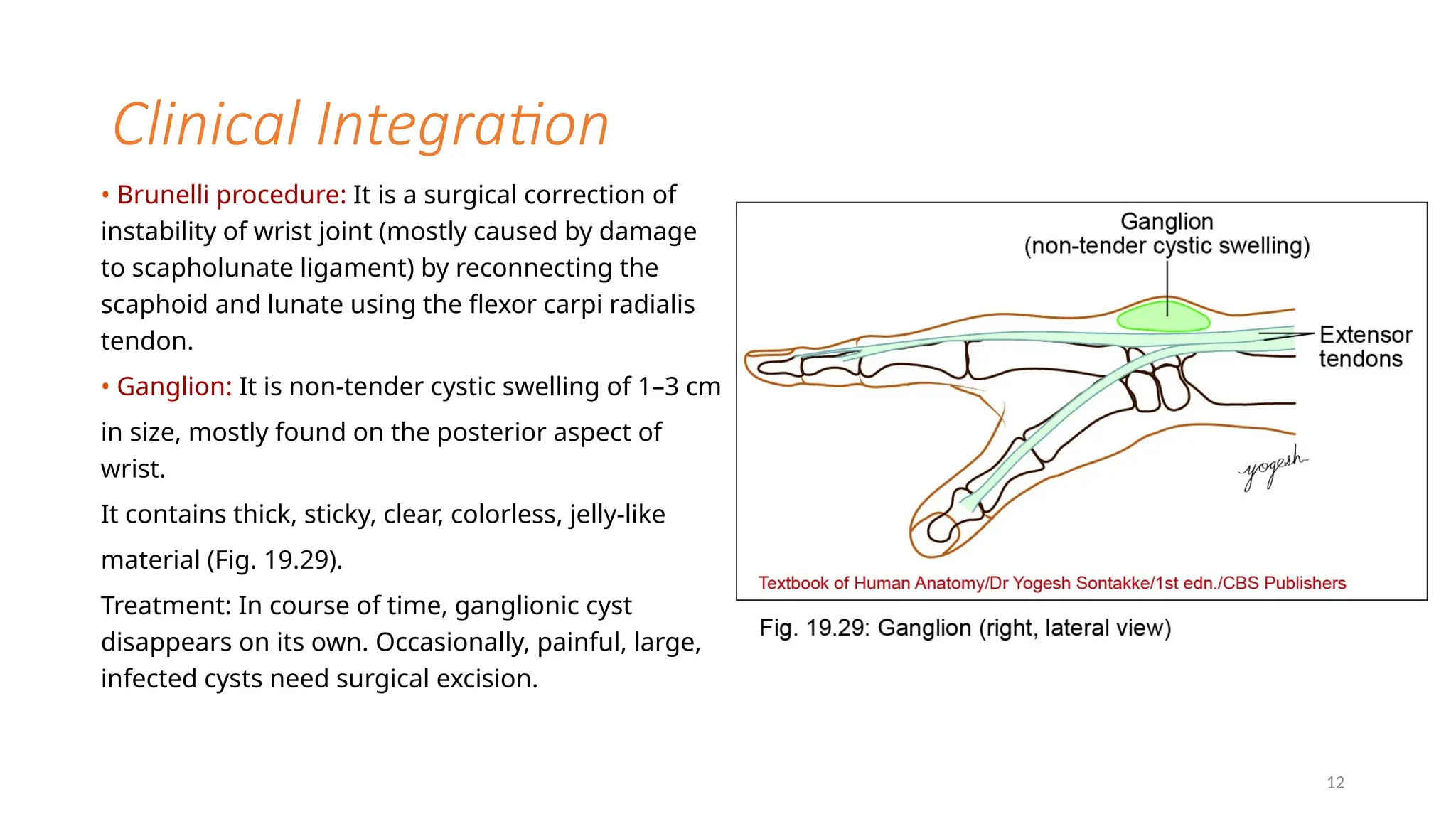 Wrist Joint and First Carpo metacarpal joint.pptx