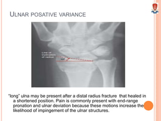 Wrist joint complex | PPT
