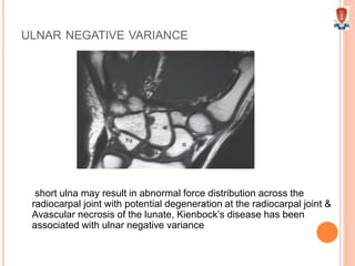 Wrist joint complex | PPT