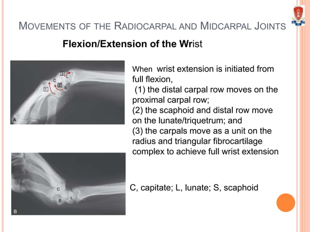 Wrist joint complex | PPT