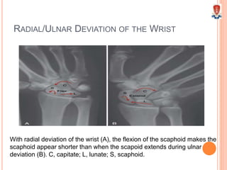 Wrist joint complex | PPTX