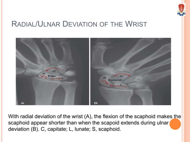 Wrist joint complex | PPT