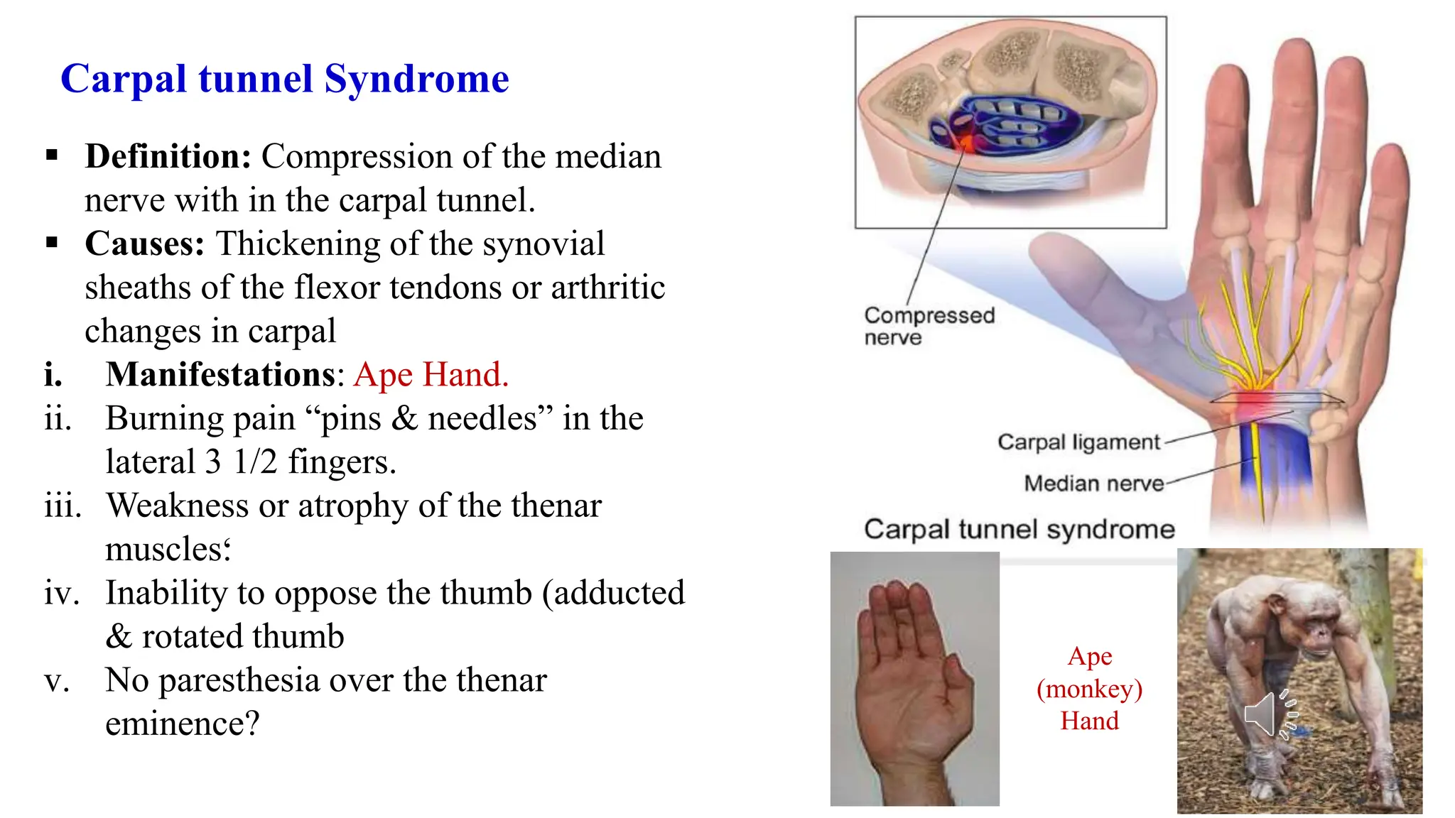 Anatomy of the Wrist joint and hand.ppsx