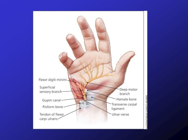 Wrist joint pathologies | PPT | Death, Injury, or Military Conflict ...