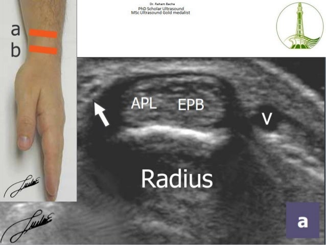 Wrist joint ultrasound
