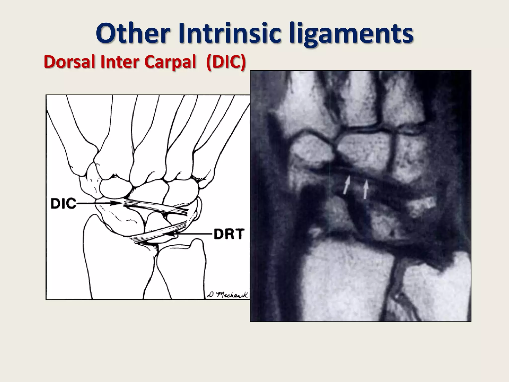Wrist ligaments | PPTX