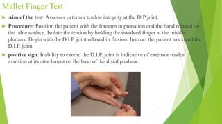 Orthopedic Test for the wrist joint | PPT