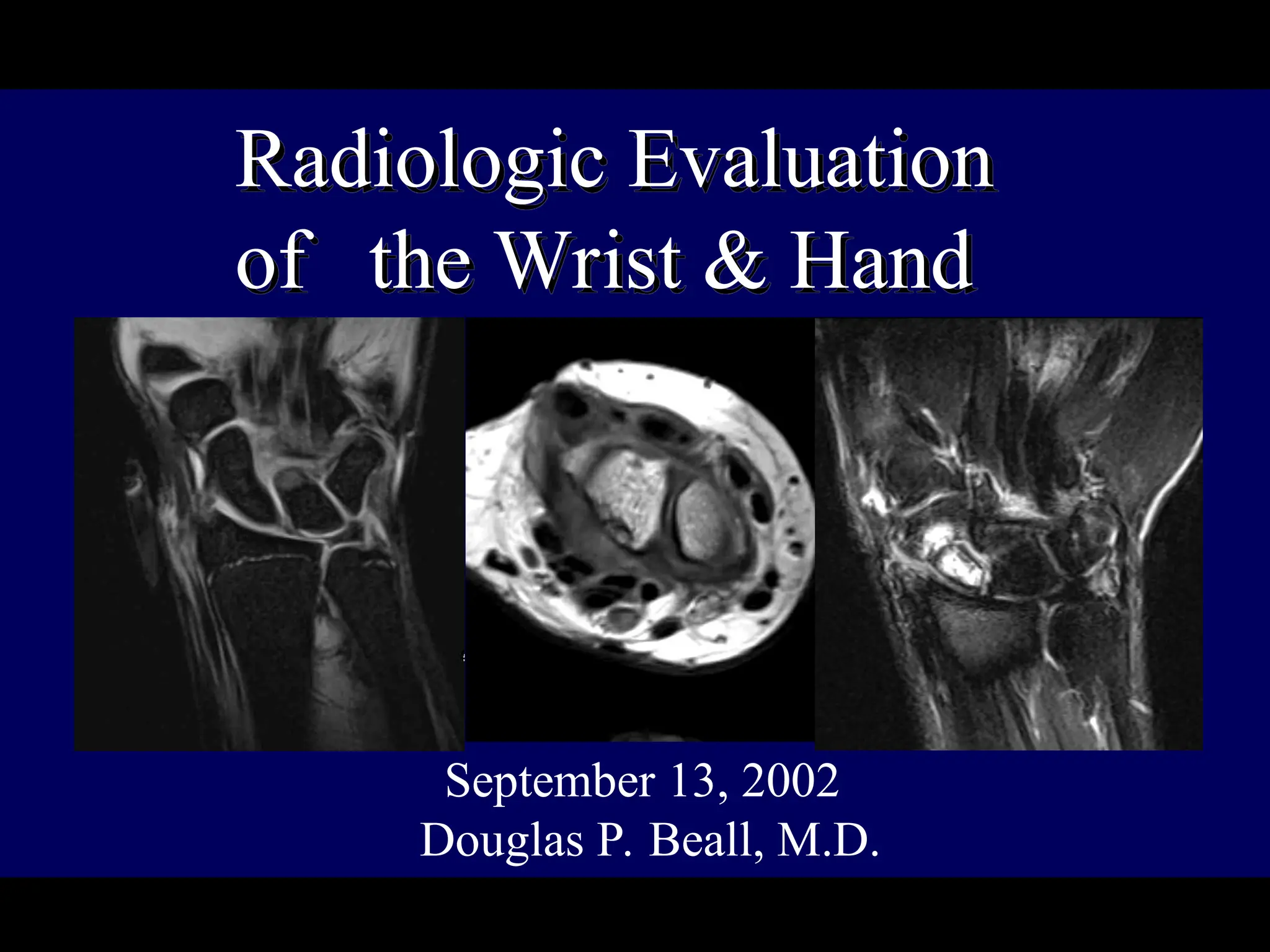 Wrist MRI Magnetic Resonance Imaging.ppt