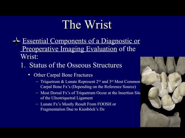 Wrist MRI Magnetic Resonance Imaging.ppt